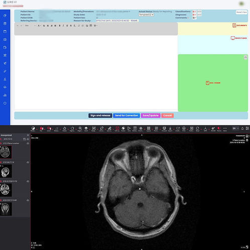 PACS with cloud computing system - U.RIS - U.RIS - medical imaging ...