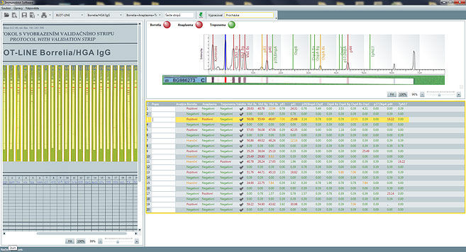 Analysis software - SwIm03 - TestLine Clinical Diagnostics - medical ...