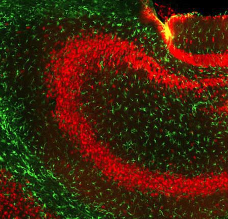 IgG reagent - GT22107 - Neuromics - for scientific research / for ...