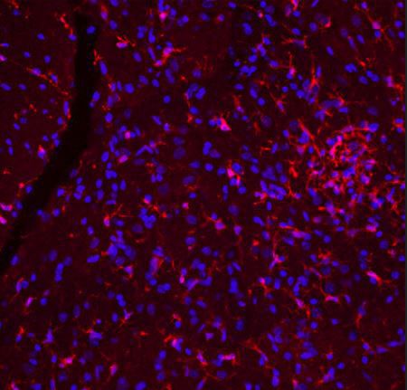 Antibody - CH22134 - Neuromics - for scientific research / for Western ...