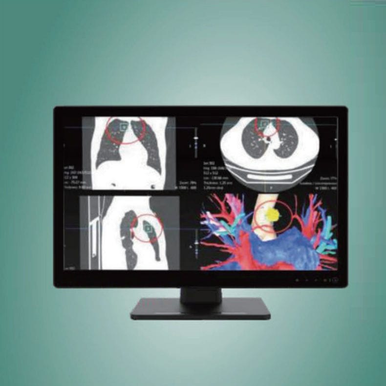 Diagnostic display - MC40A - ZRT Technology - 2560 × 1440 / 27" / remote