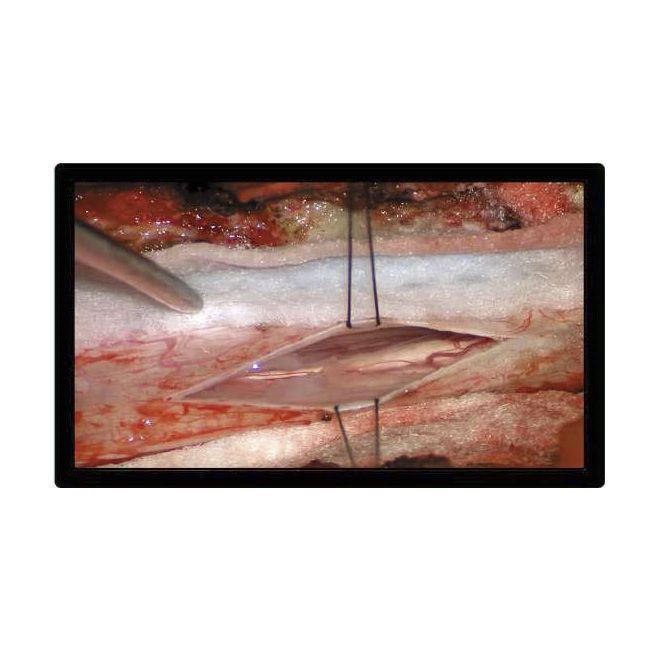 Operating room display - MS8320P - ZRT Technology - endoscopy / 3840 × ...