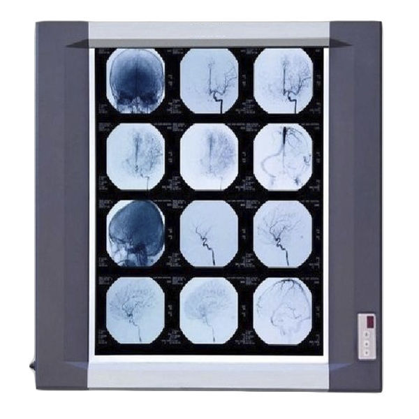 Digital X-ray film viewer - MV-FV5 - Mediveron - 1-screen / LED ...