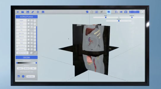 Analysis software - Fluxus - Avamed Synergy - treatment / planning ...