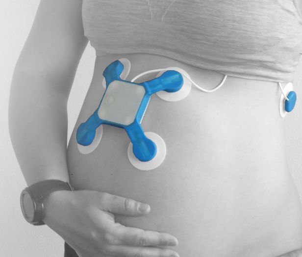 Maternity AI platform - Baymatob - monitoring / diagnostic