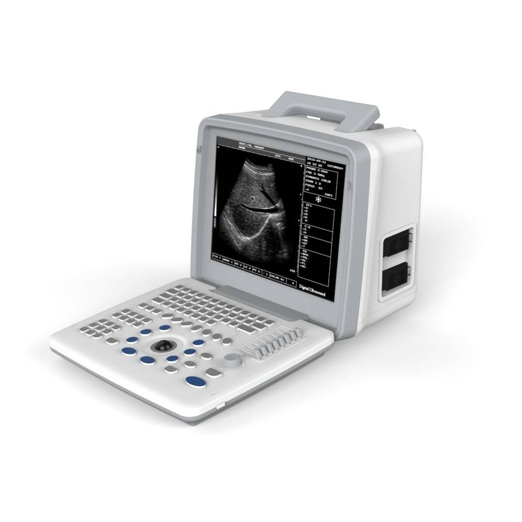 Portable ultrasound system - S300 - Somo International - for ...