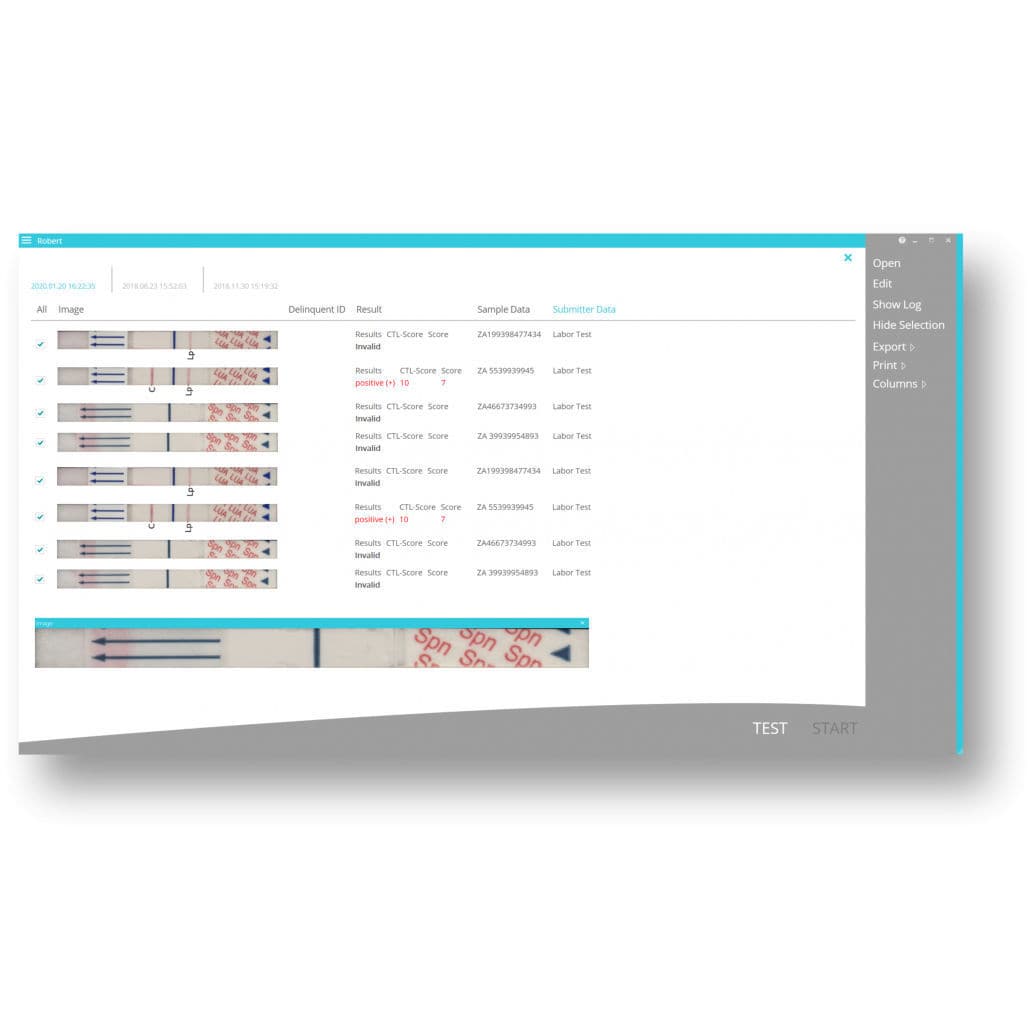 Analysis software - B5 - BioSciTec GmbH - test / interpretation ...