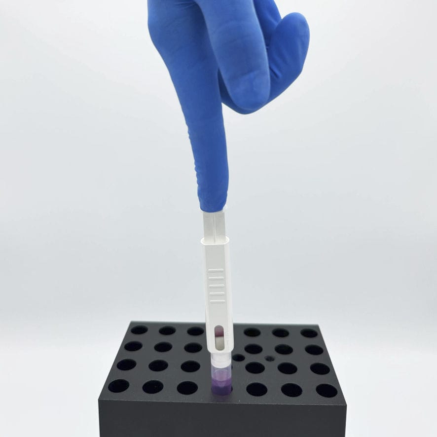 Rapid sepsis test - SeptiLoop - Loop Diagnostics S.L. - bacteria ...