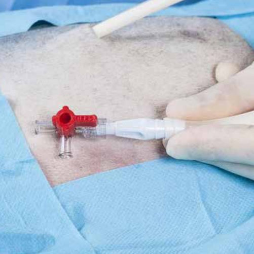 Medical valve - 00120001 - QUIROSA, S.A - blue / red