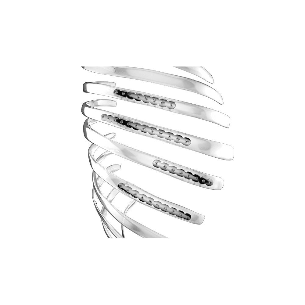 Rib compression plate - 2700 series - Aplus Biotechnology - locking ...