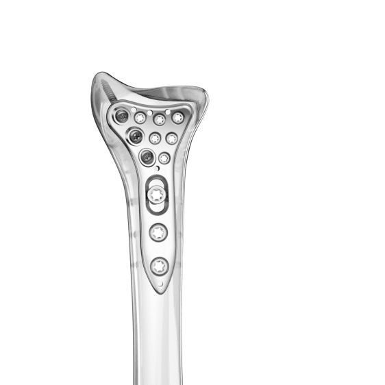 Radius compression plate - 0401-0000:0001-02 - Aplus Biotechnology ...