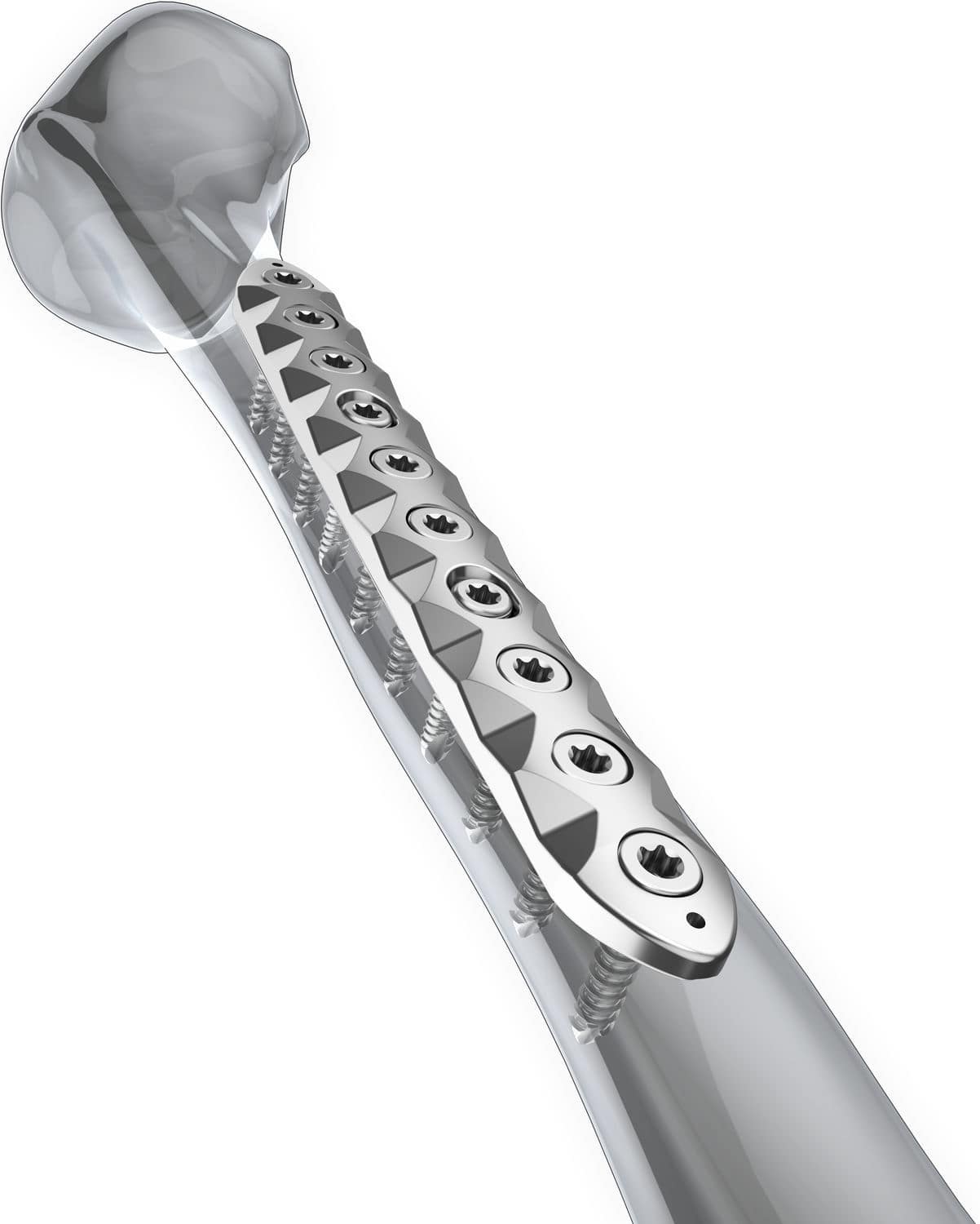 Tibia compression plate - Aplus Biotechnology - mid-shaft / locking ...