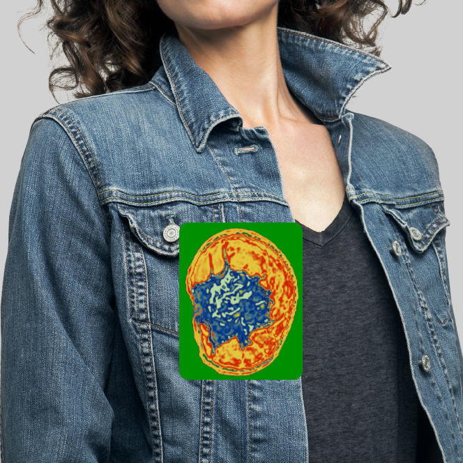 Medical imaging AI platform - QP-Breast® - Quibim - interpretation ...