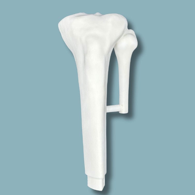 Tibia anatomical model - 03-13-02 - ADDIDREAM - surgery / training / trauma