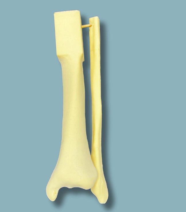 Tibia anatomical model - 03-19-01 - ADDIDREAM - fibula / surgery / training