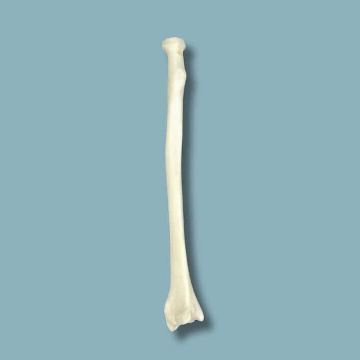 Radius anatomical model - 13-01-01 - ADDIDREAM - surgery / training ...