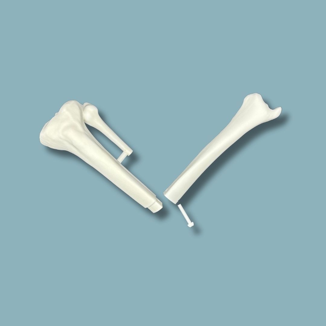 Tibia anatomical model - 03-12-02 - ADDIDREAM - surgery / training ...