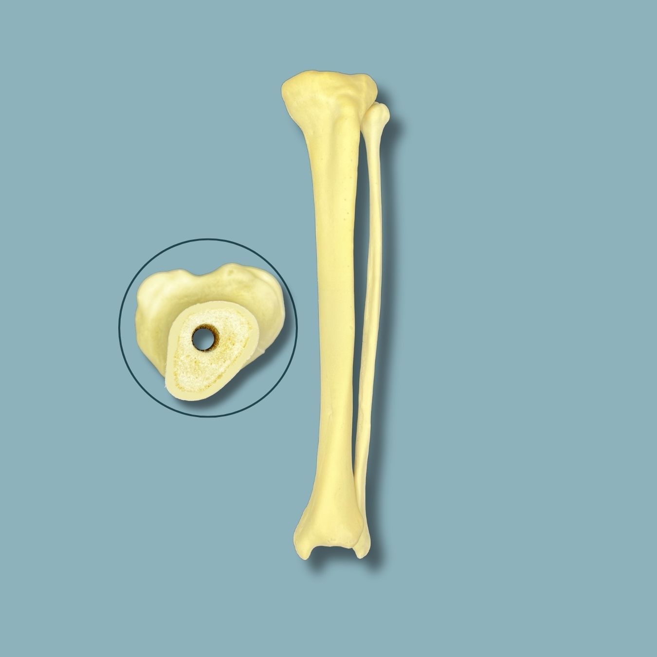 Tibia anatomical model - 03-10-01 - ADDIDREAM - fibula / surgery / training