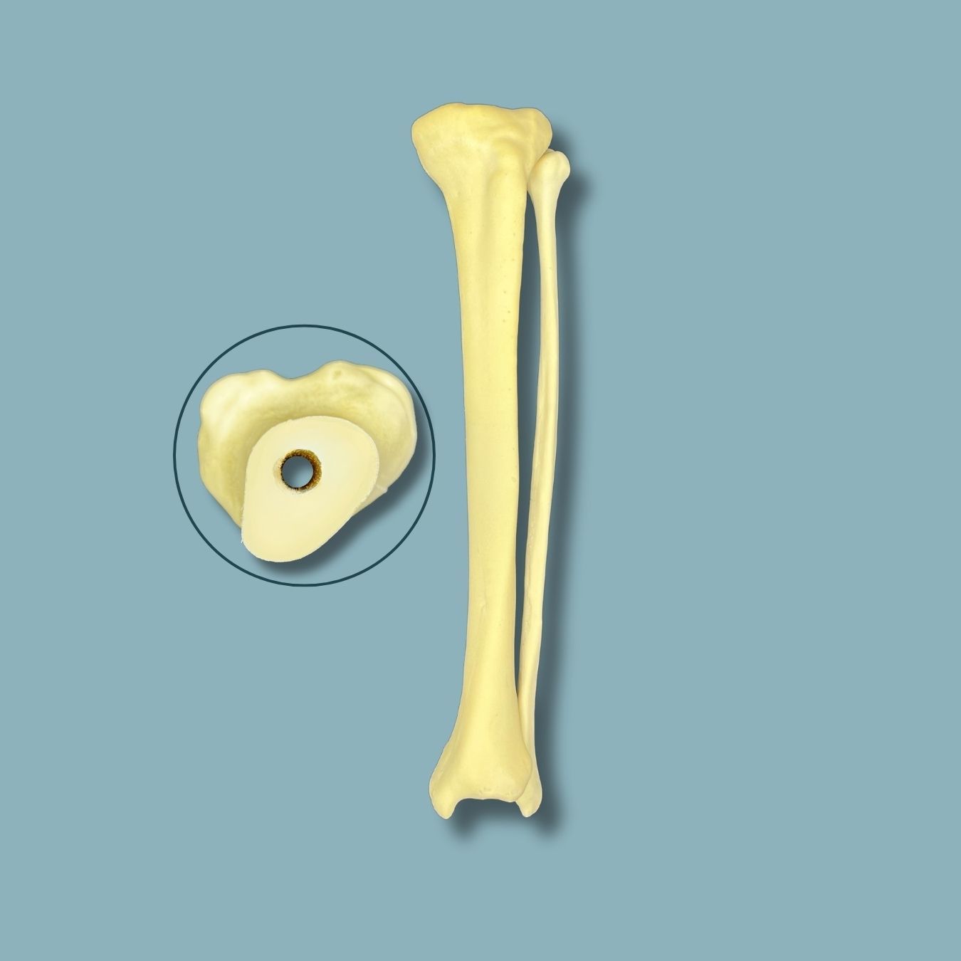 Bone model - 03-22-02 - ADDIDREAM - tibia / surgery / training