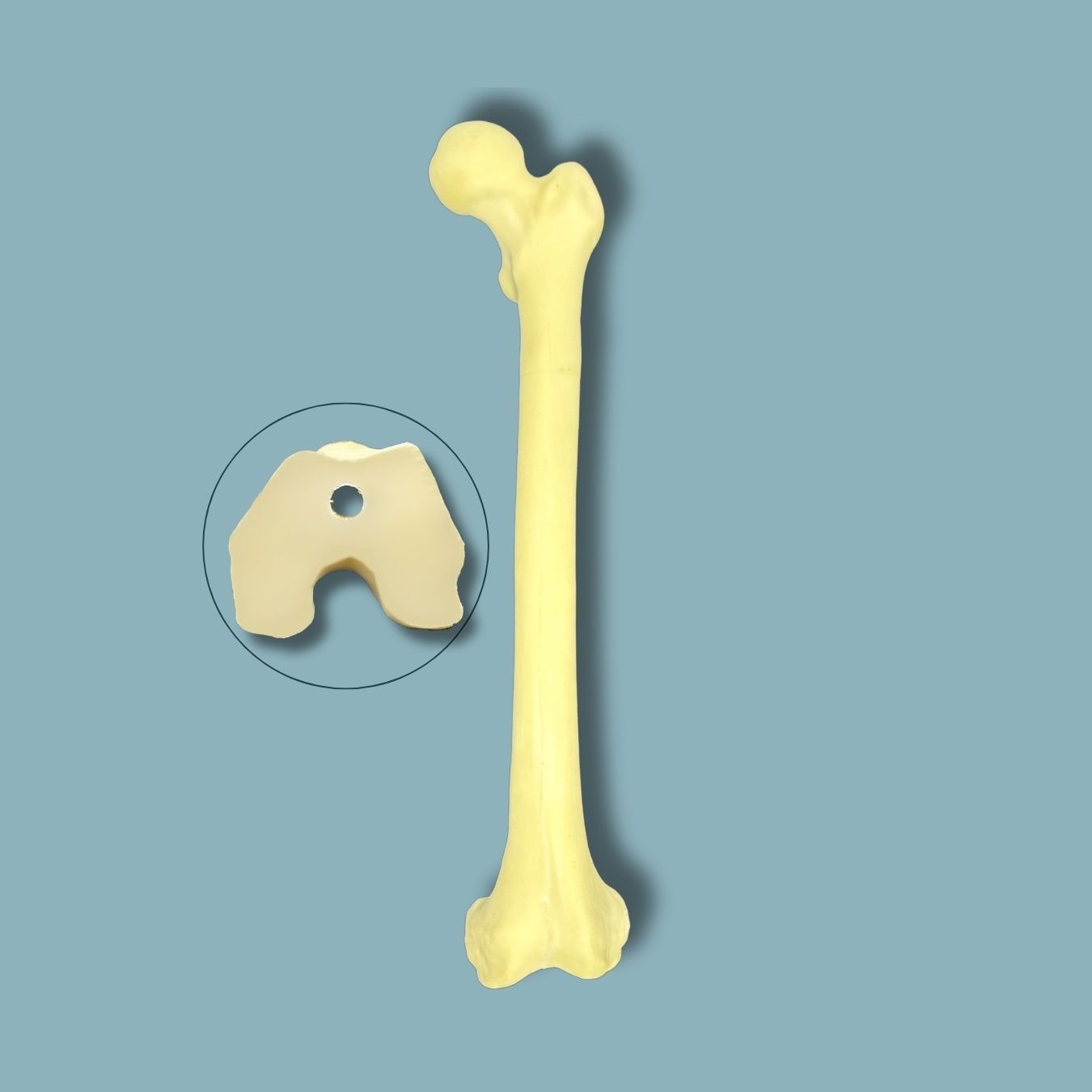Bone model - 05-11-02 - ADDIDREAM - femur / surgery / training