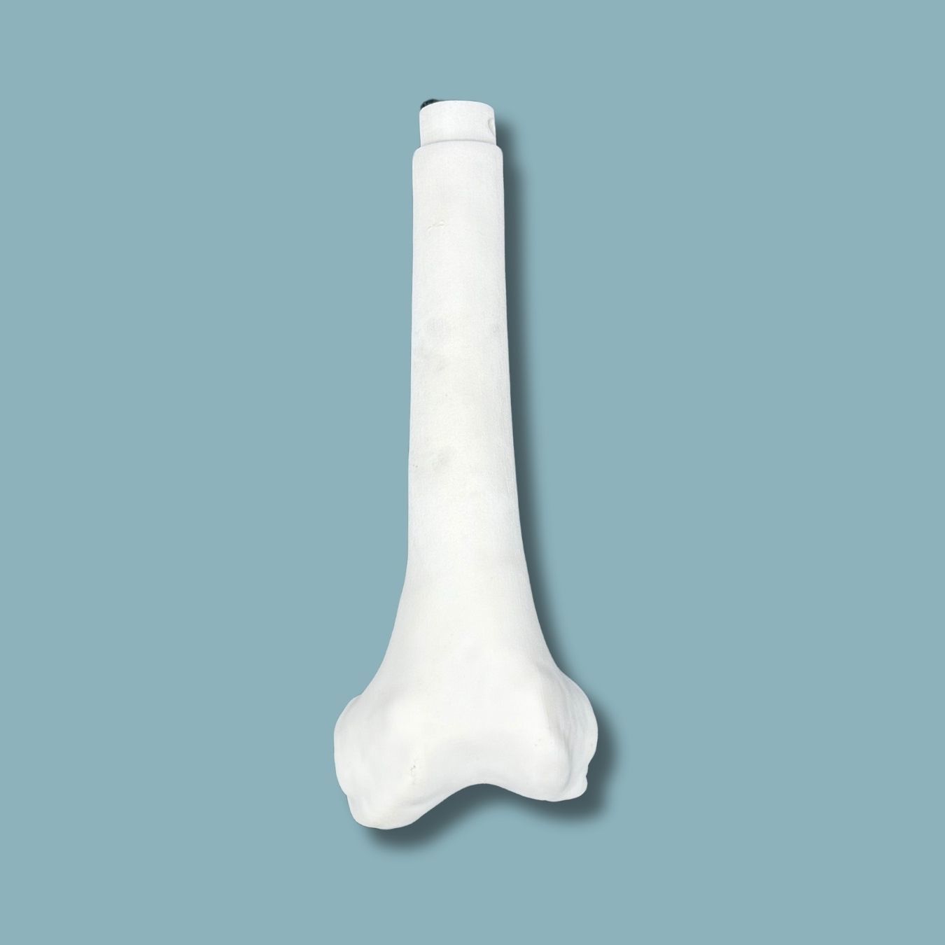 Femur anatomical model - 05-09-02 - ADDIDREAM - surgery / training ...