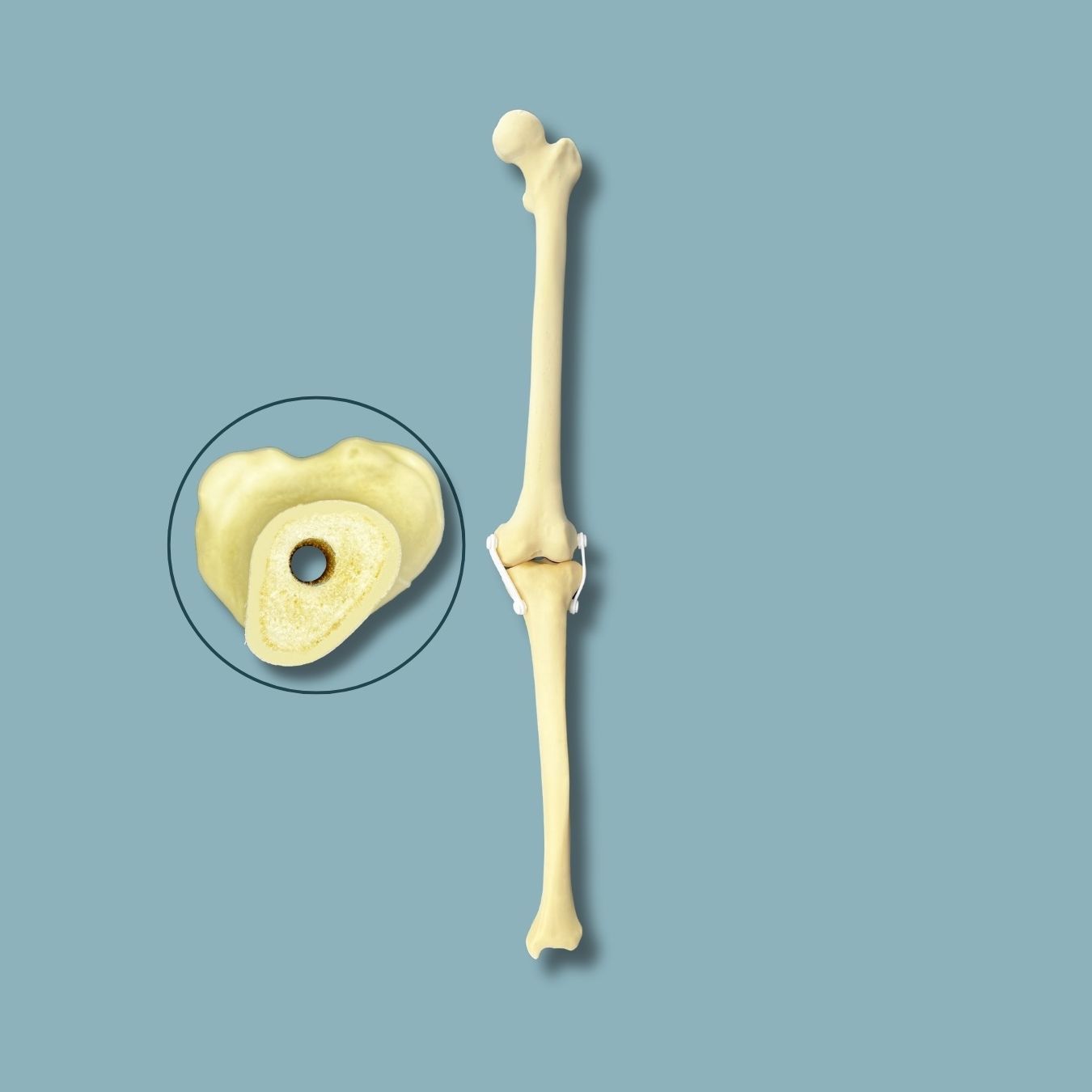 Knee model - 04-04-02 - ADDIDREAM - surgery / training / foam