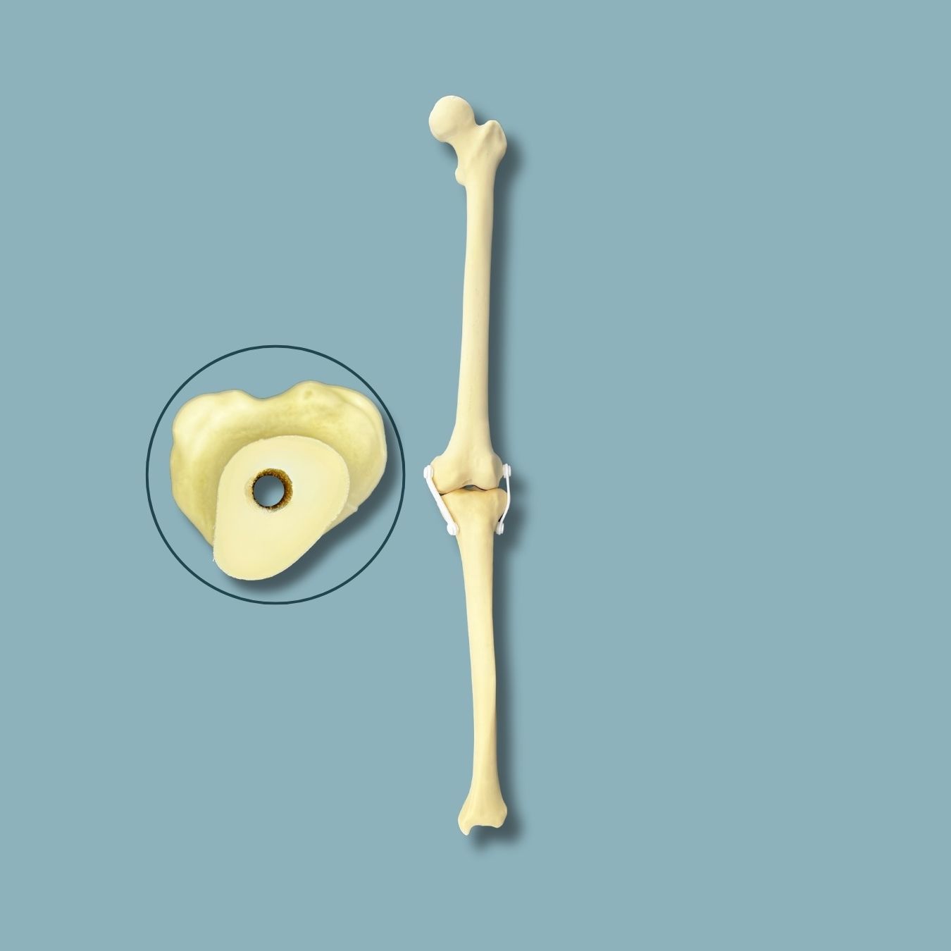 Knee model - 04-31-01 - ADDIDREAM - bone / surgery / training