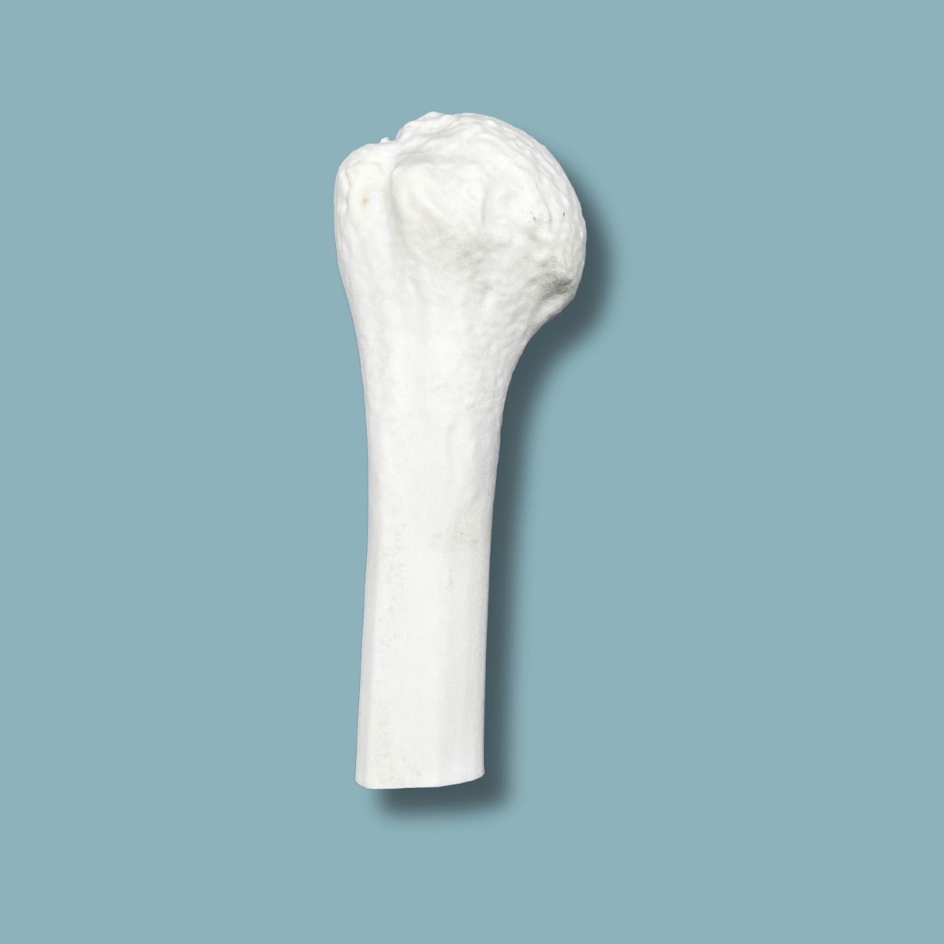 Bone model - 16-06-02 - ADDIDREAM - humerus / surgery / for shoulder ...