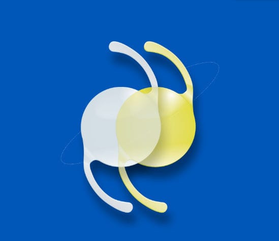 Monofocal intraocular lens - Vivinex™multiSert™ - HOYA Medical Singapore