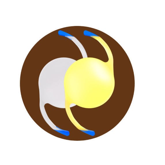 Monofocal intraocular lens - ezSert™ - HOYA Medical Singapore - PMMA