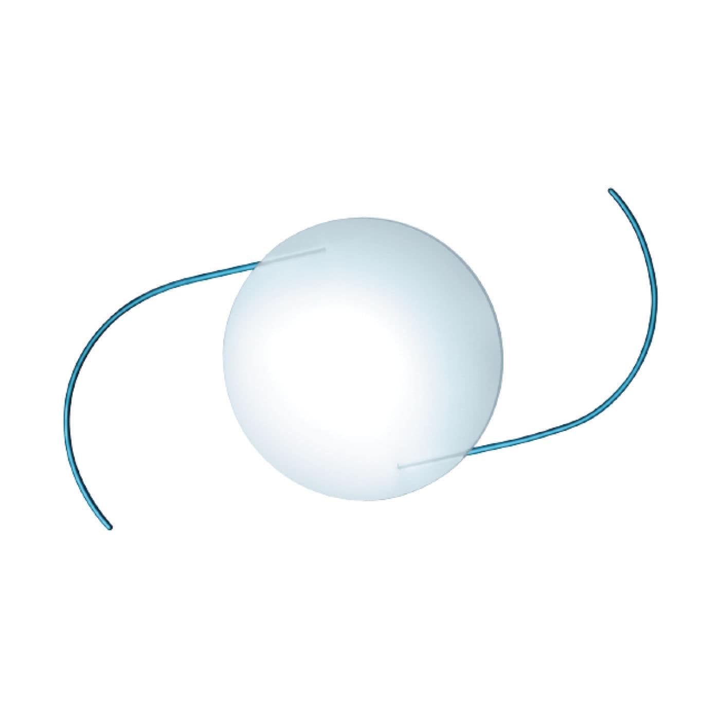 Trifocal intraocular lens - Precisal 300AC - Ophtec