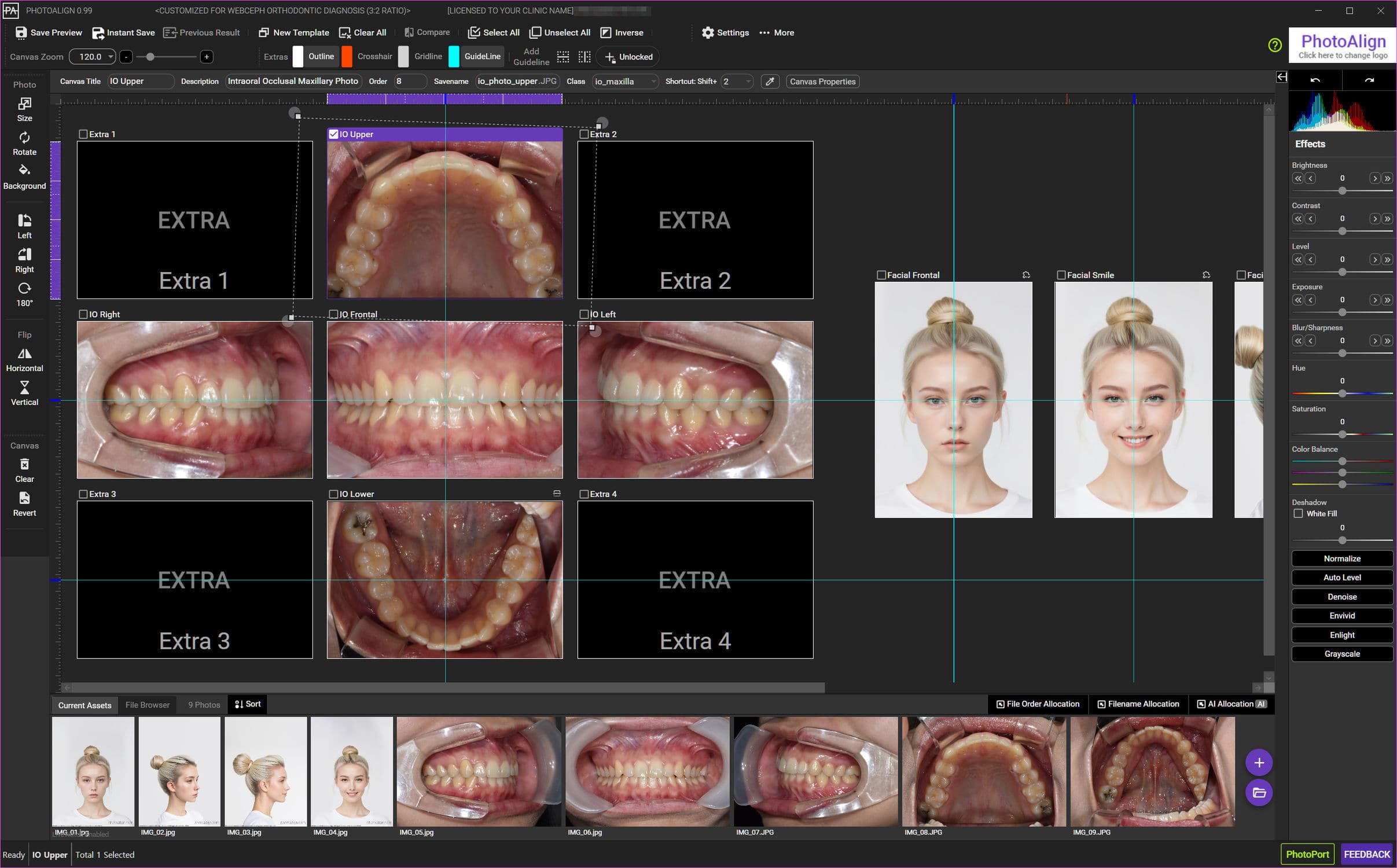 Image editing software - Photoalign - PhotoAlign - image analysis / data management / patient ...
