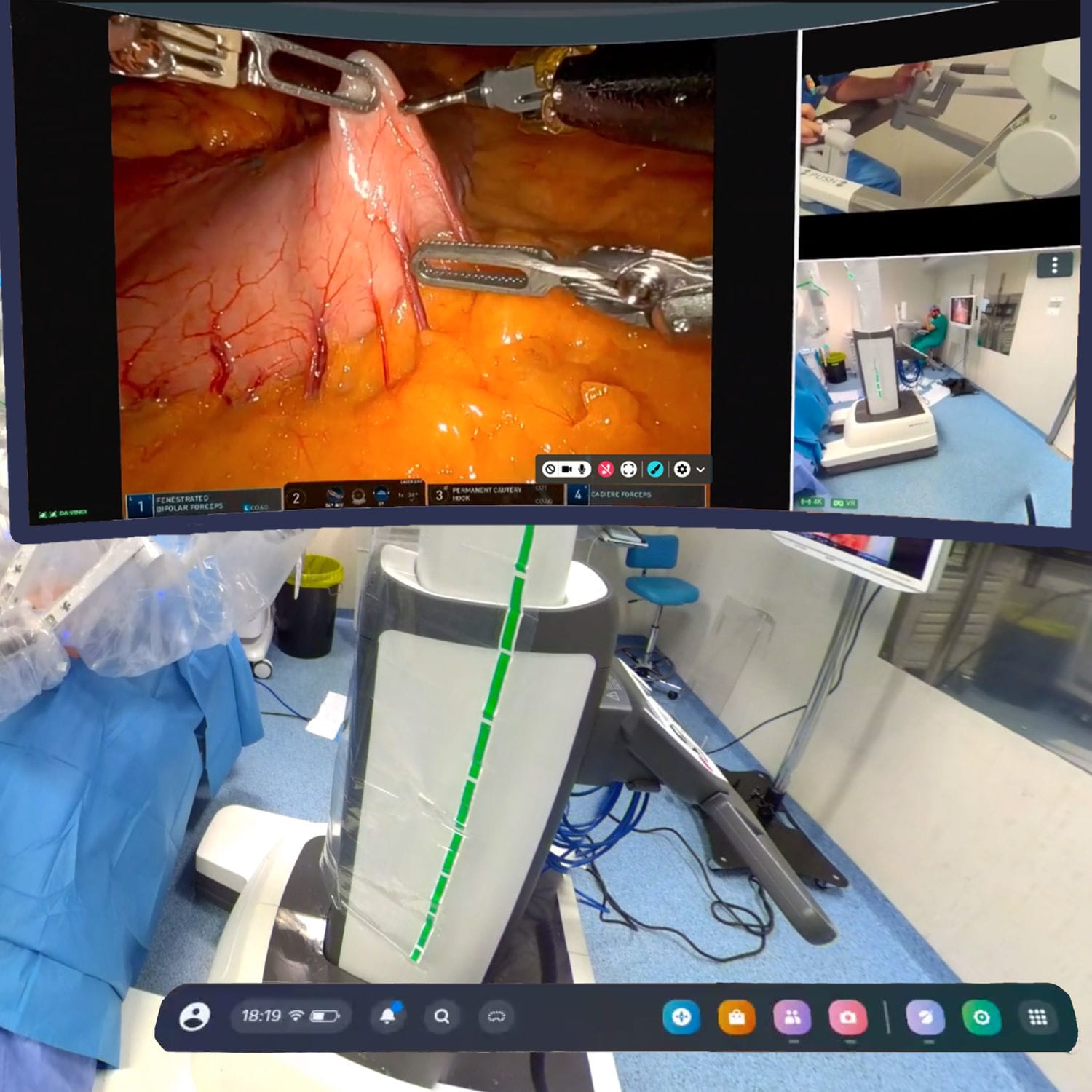 4K OR video system - mSurgery - mSurgery - MP4 / MPEG / AVI