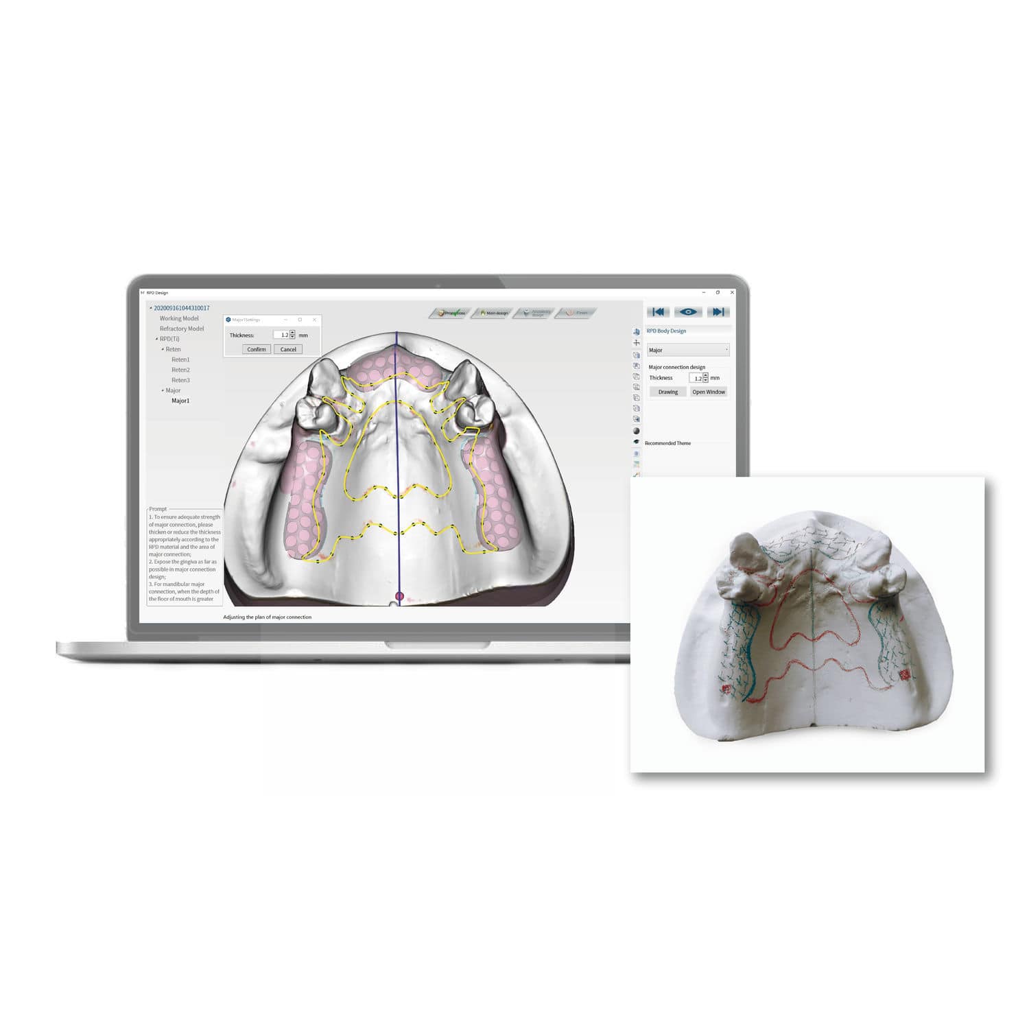 Design software - iPD - Profeta 3D - scan / medical / dental