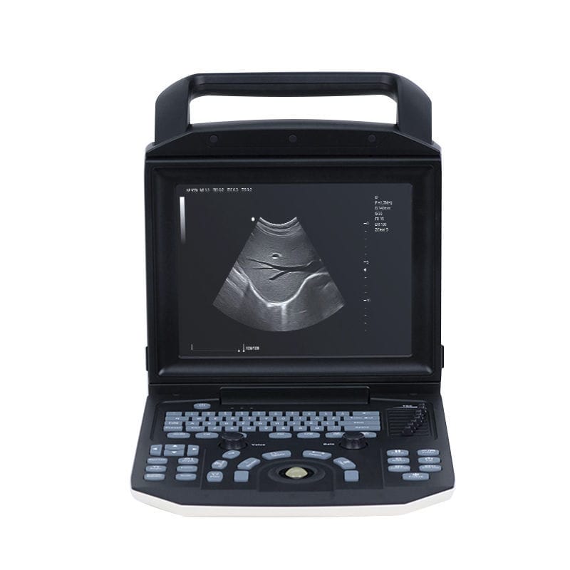 Portable ultrasound system - YSB-M5 - YSENMED - for multipurpose ...
