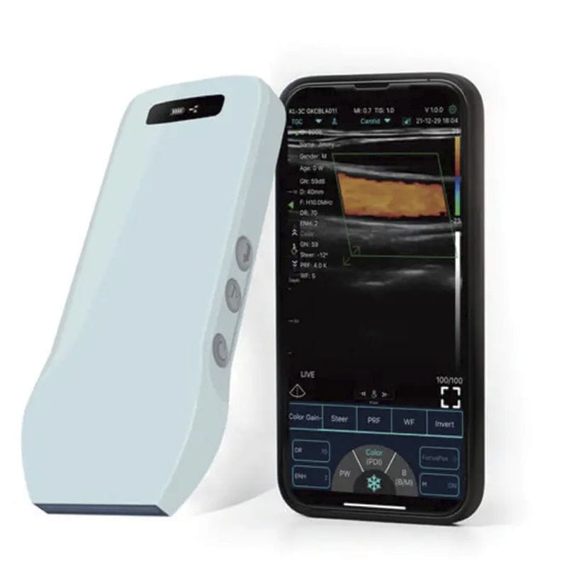 Hand-held ultrasound system - YSB-C10CX - YSENMED - for multipurpose ...