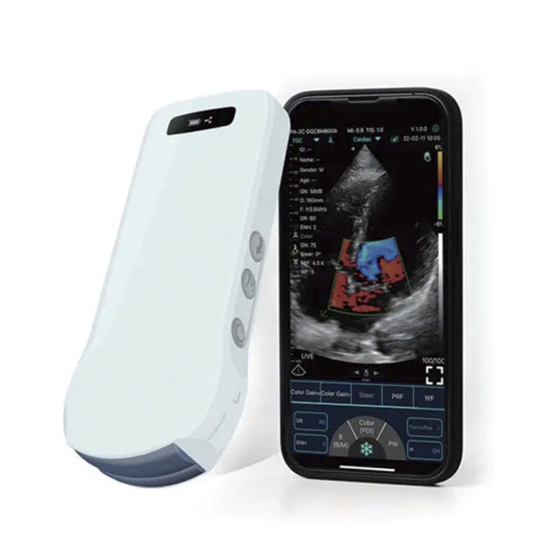 Hand-held ultrasound system - YSB-C10T - YSENMED - for multipurpose ...