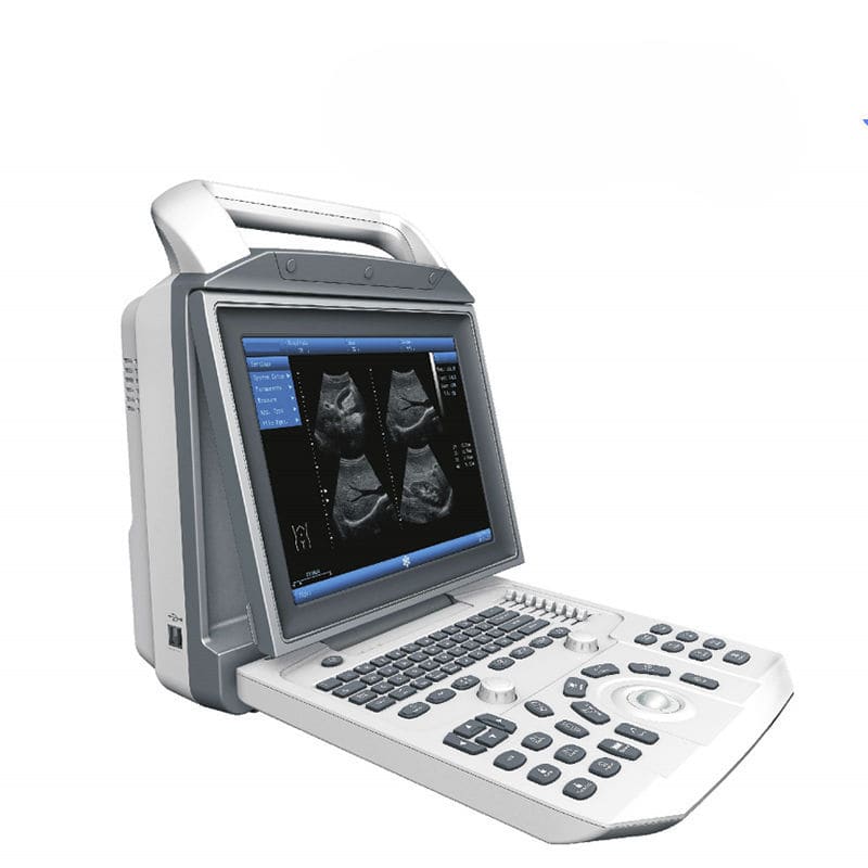 Portable ultrasound system - YSB-i50 - YSENMED - for multipurpose ...