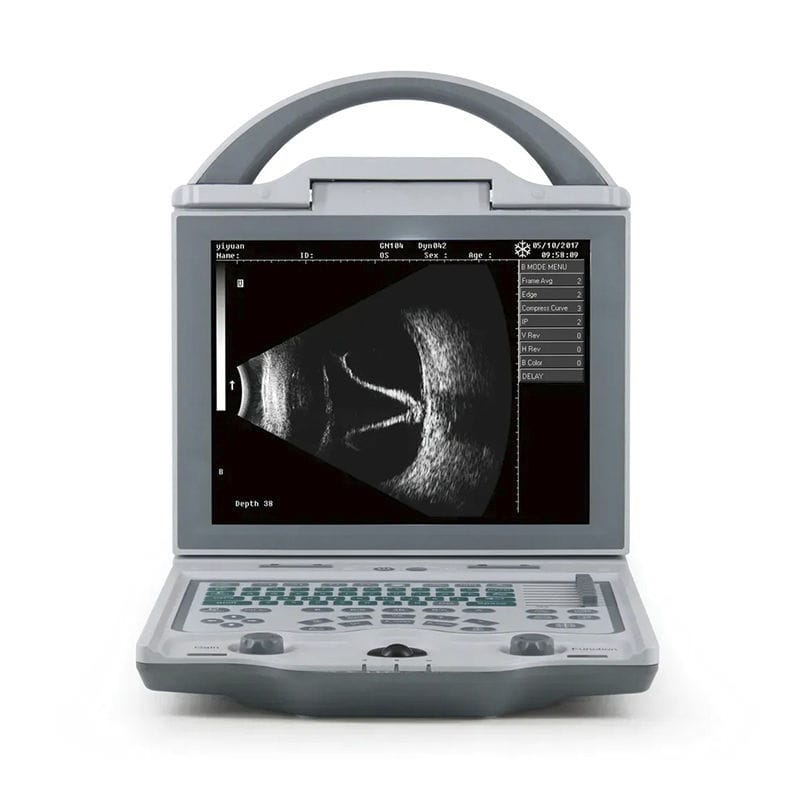 Portable ultrasound system - YSODU5 - YSENMED - for ophthalmic ...