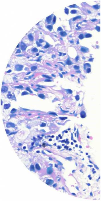 Lung cancer test kit - PULMOCAN™ - Geneseeq - oncology / for precision ...