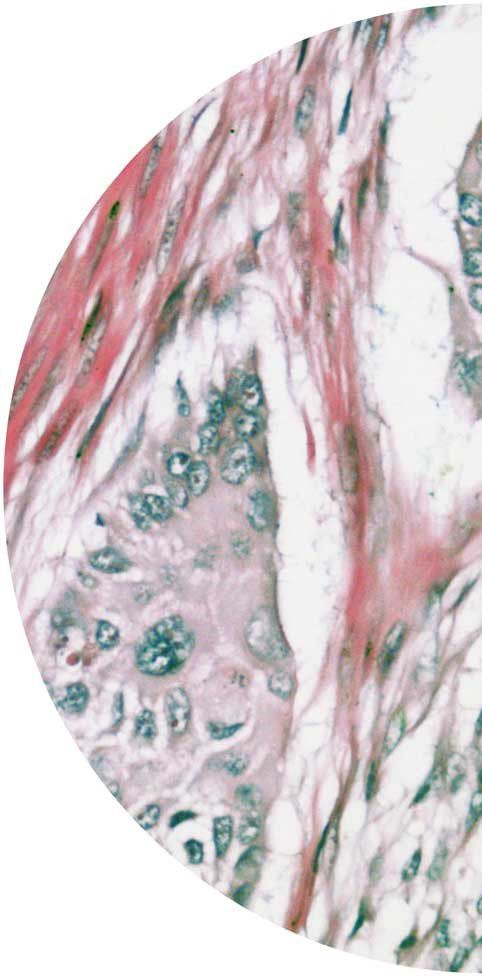 Colorectal cancer test kit - INTESCAN™ - Geneseeq - for small intestine ...