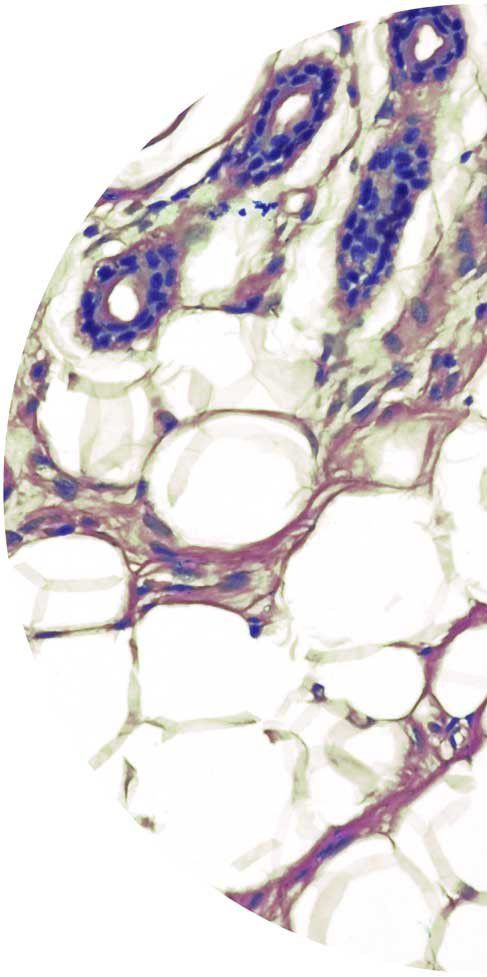 Melanoma test kit - MELACAN™ - Geneseeq - oncology / for precision ...