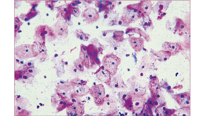 Stain reagent kit - Wuhan Jinhong Biotech Development Co., Ltd. - for ...