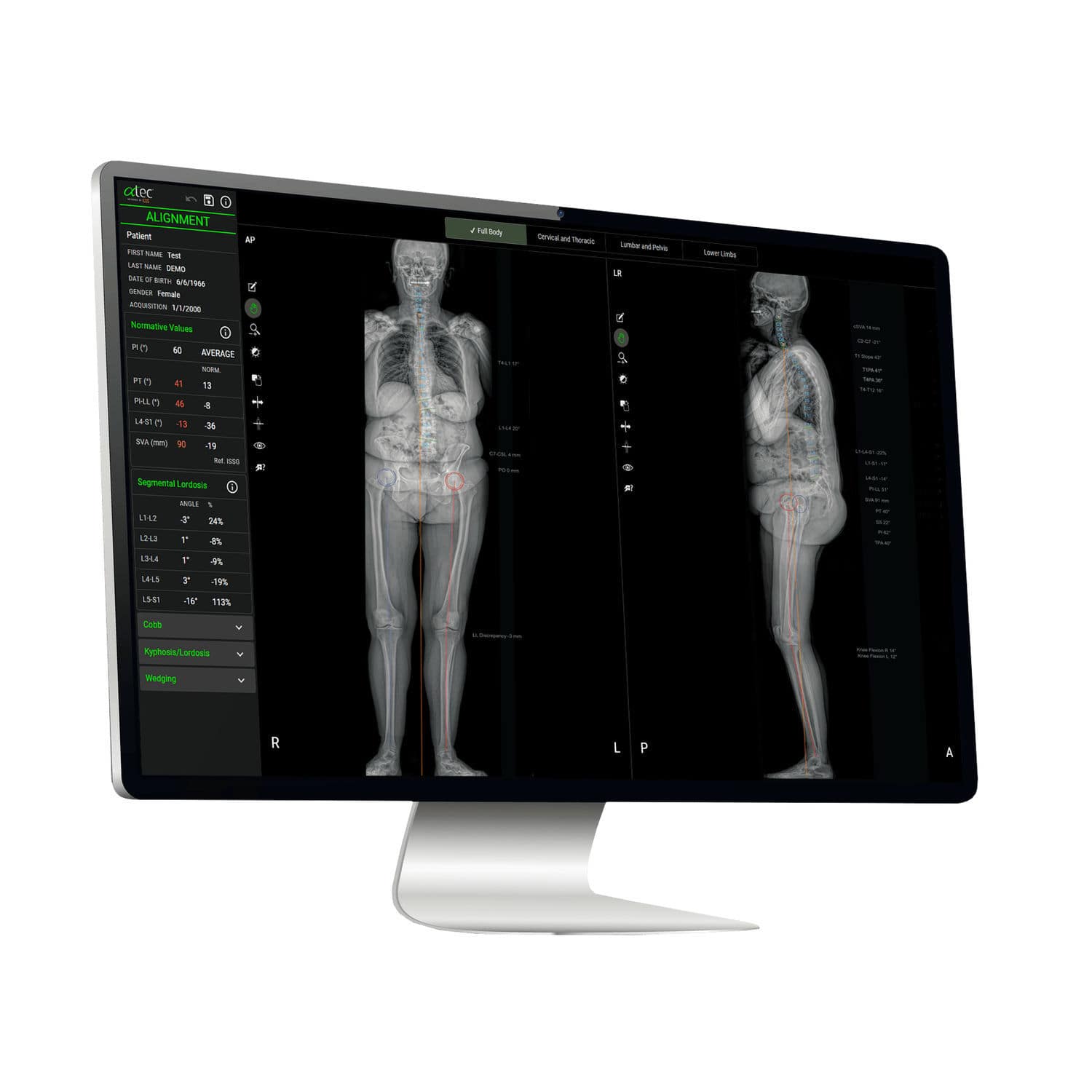 Medical AI platform - EOS IMAGING - medical imaging / for ...