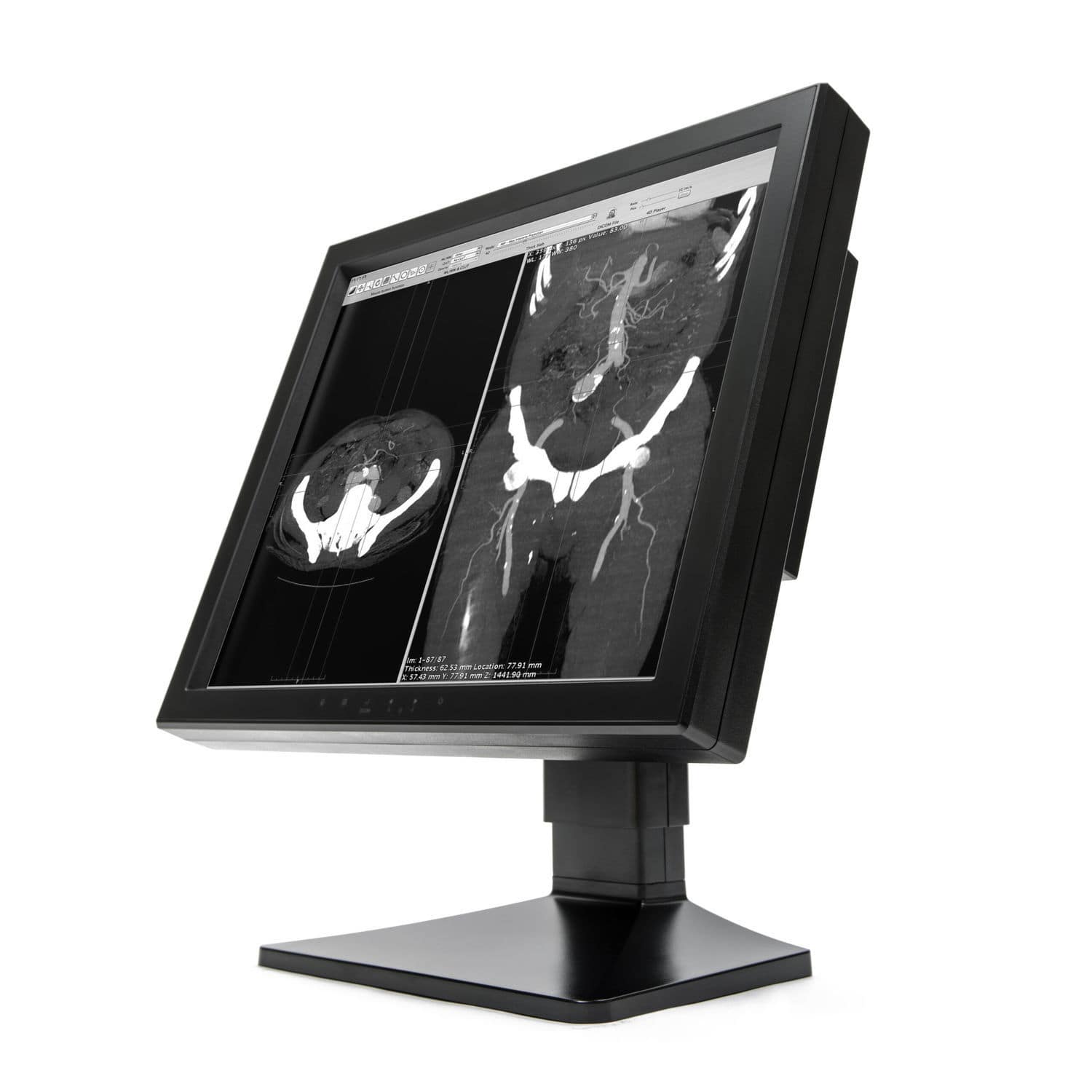 Diagnostic display - MX10P - Wide USA Corporation - medical imaging ...