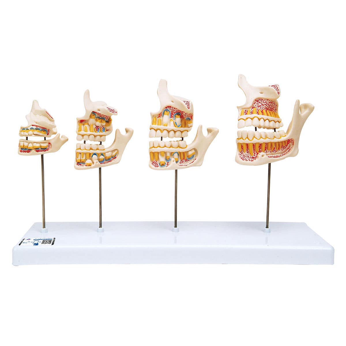 Jaw anatomical model - D20 - 3B Scientific - teeth / for teaching