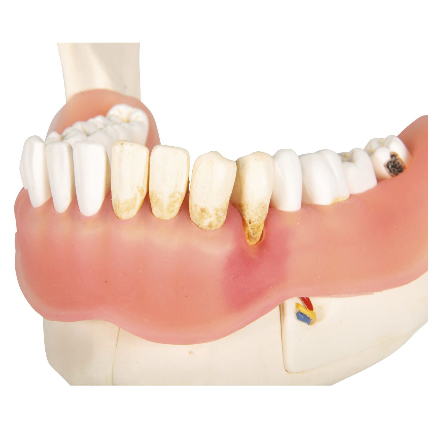 Jaw anatomical model - D26 - 3B Scientific - teeth / for teaching