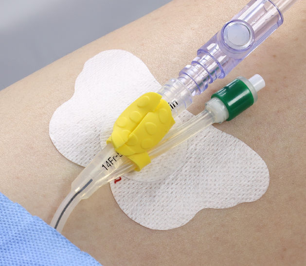 Urinary drainage catheter band - Wing Grip Foley - ACE Medical - leg ...