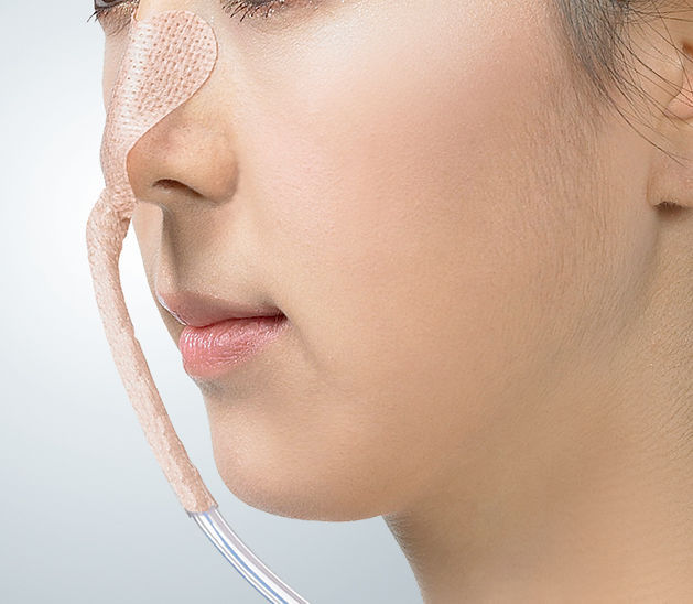 Nasogastric tube catheter fixation - Grip Levin - ACE Medical - head ...