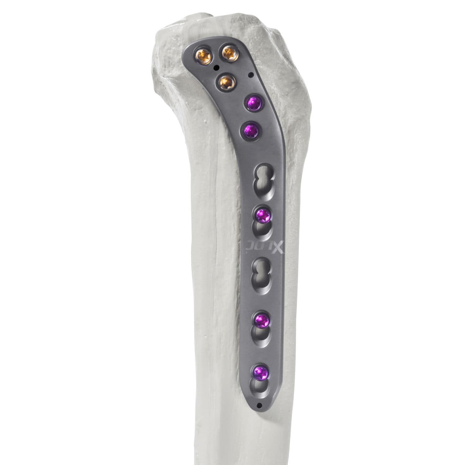 Tibia compression plate - 10-62603 - AF Medical - proximal / lateral ...
